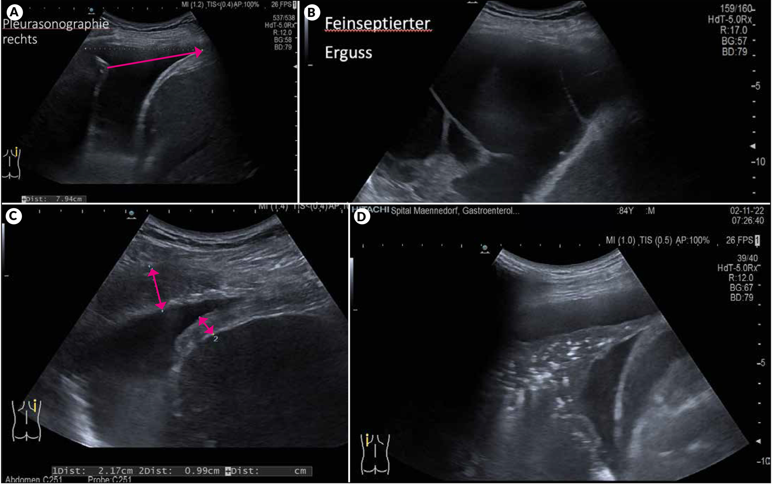 Thoracic Sonography - An Overview | Published in healthbook TIMES Das ...