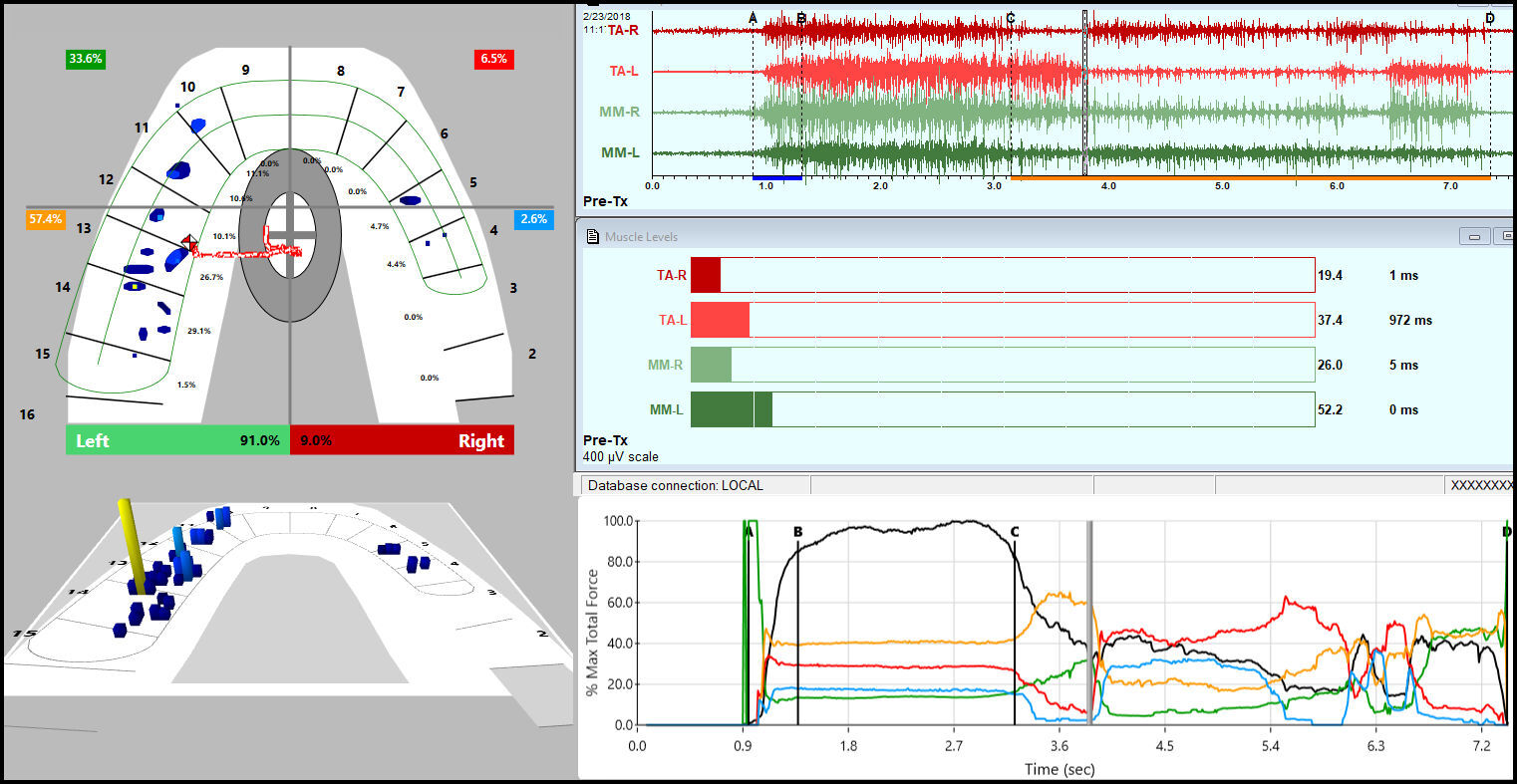 Digital evaluation of Occlusion in Treating a Patient Suffering from ...