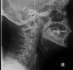 CONE BEAM COMPUTED TOMOGRAPHY: TECHNOLOGY OVERVIEW, DOSE, AND UTILITY ...