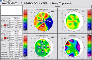 Management of Pediatric Open Globe Injury With Fenestrated Scleral Lens ...