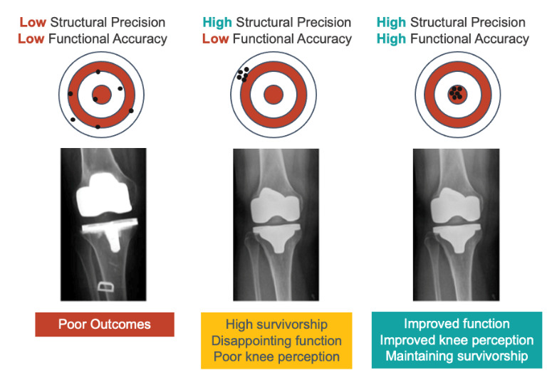 A New Paradigm in the Management of Knee Osteoarthritis and ...