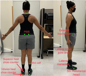 Implementation of 2D Running Gait Analysis in Orthopedic Physical ...