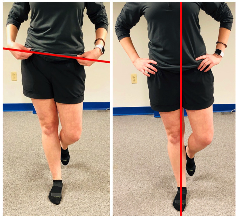 single leg squat normative data