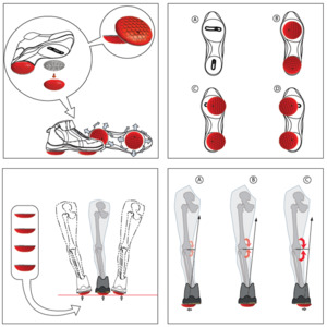 Summary of outcomes of a non-invasive biomechanical therapy for ...