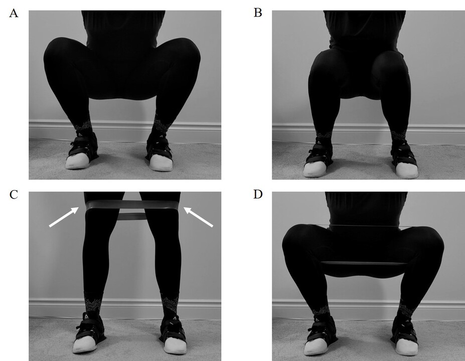 valgus squat collapse