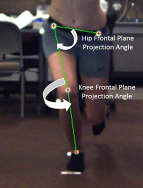 Comparison of the Frontal Plane Projection Angle and the Dynamic Valgus ...