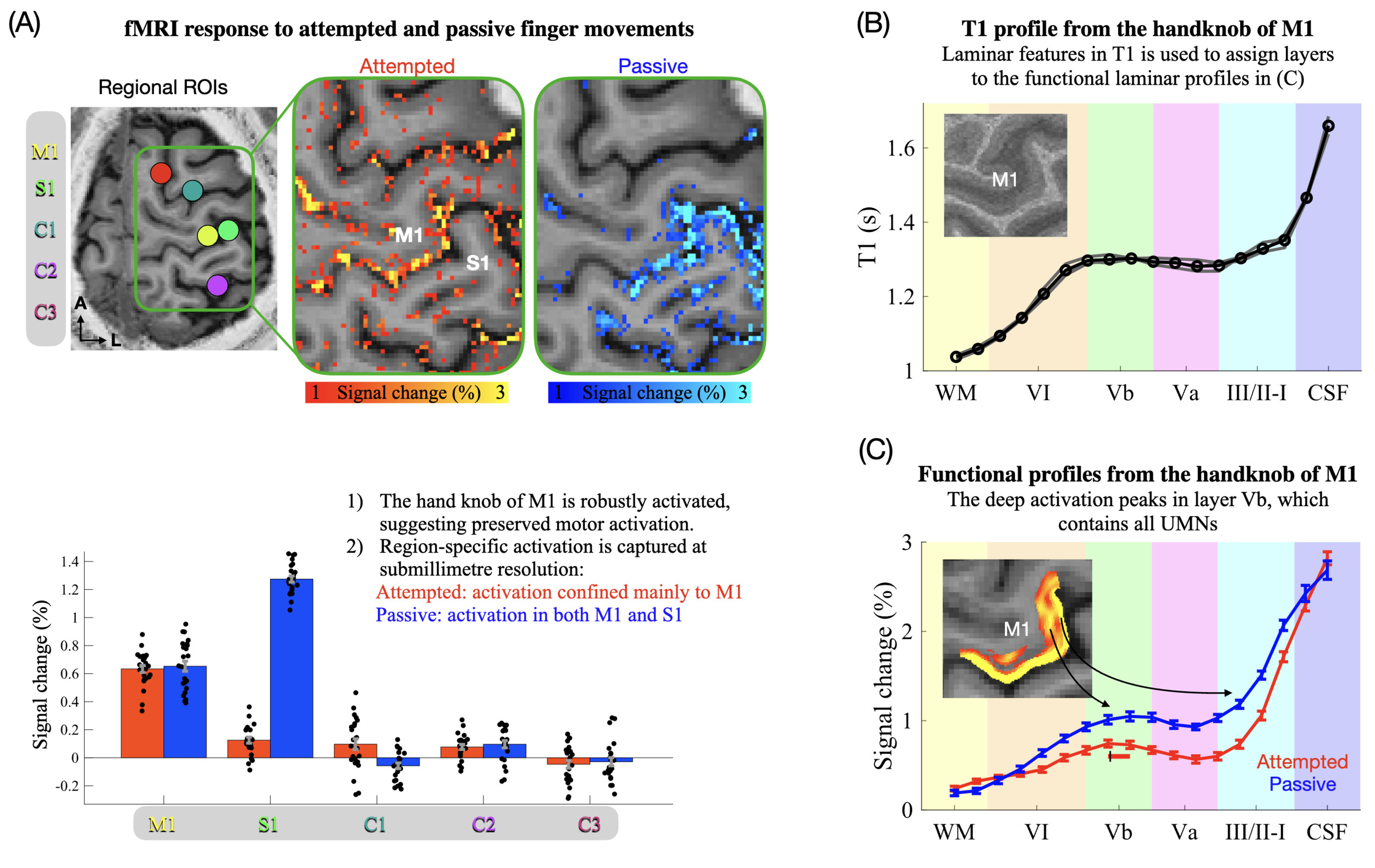 Laminar fMRI in the locked-in stage of amyotrophic lateral sclerosis ...