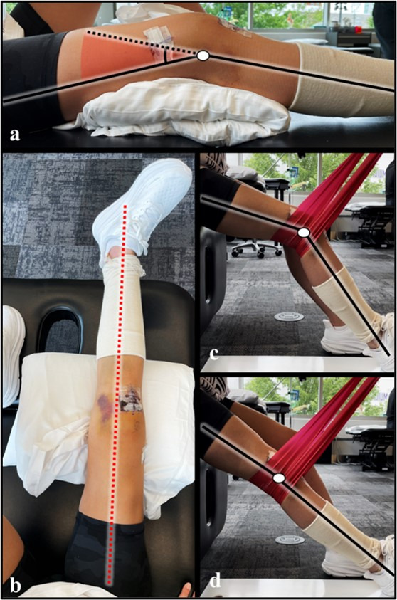 Oh, My Quad: A Clinical Commentary And Evidence-Based Framework for the ...