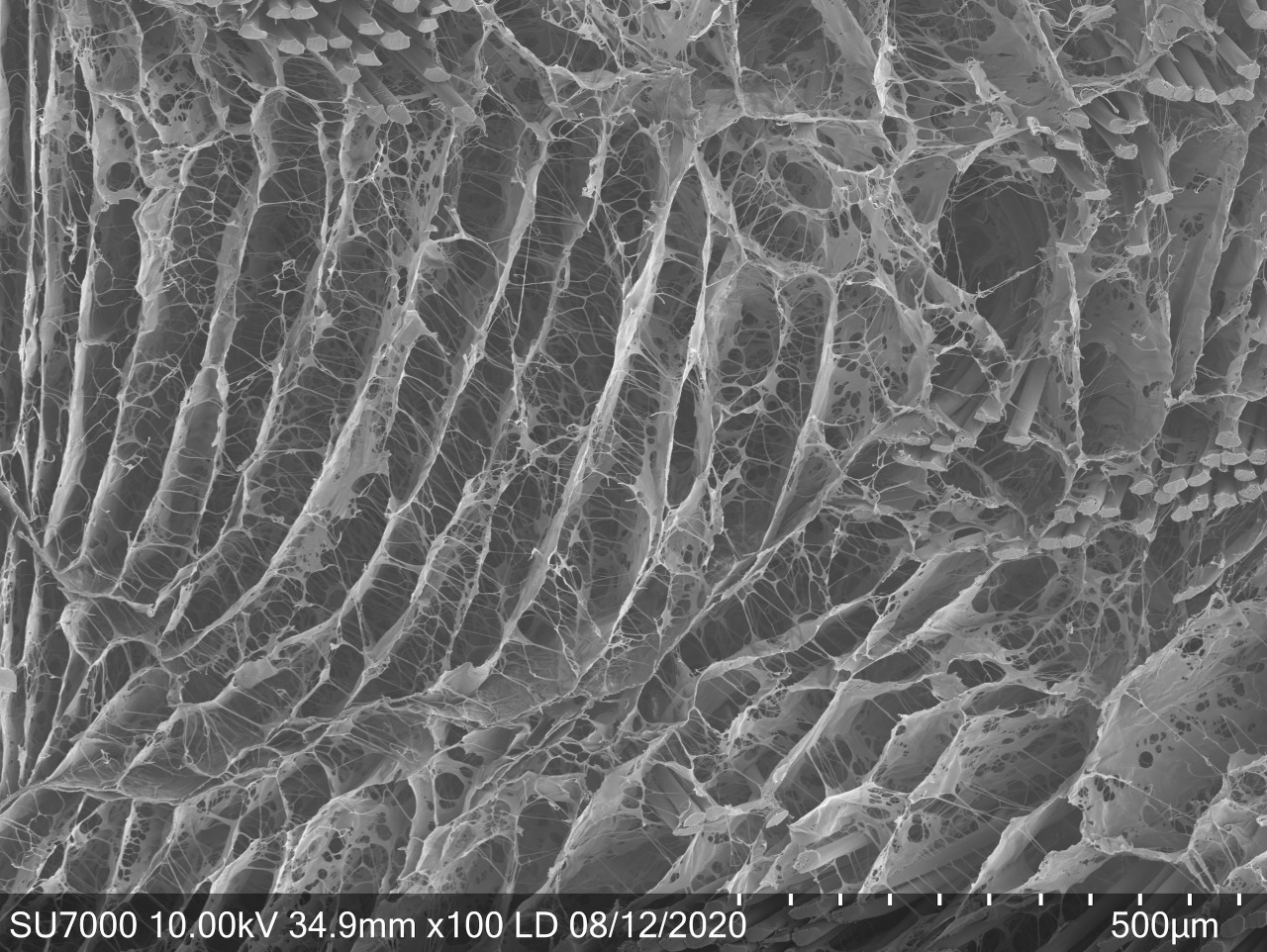 The Next Frontier for Rotator Cuff Augmentation? Strength + Bio ...