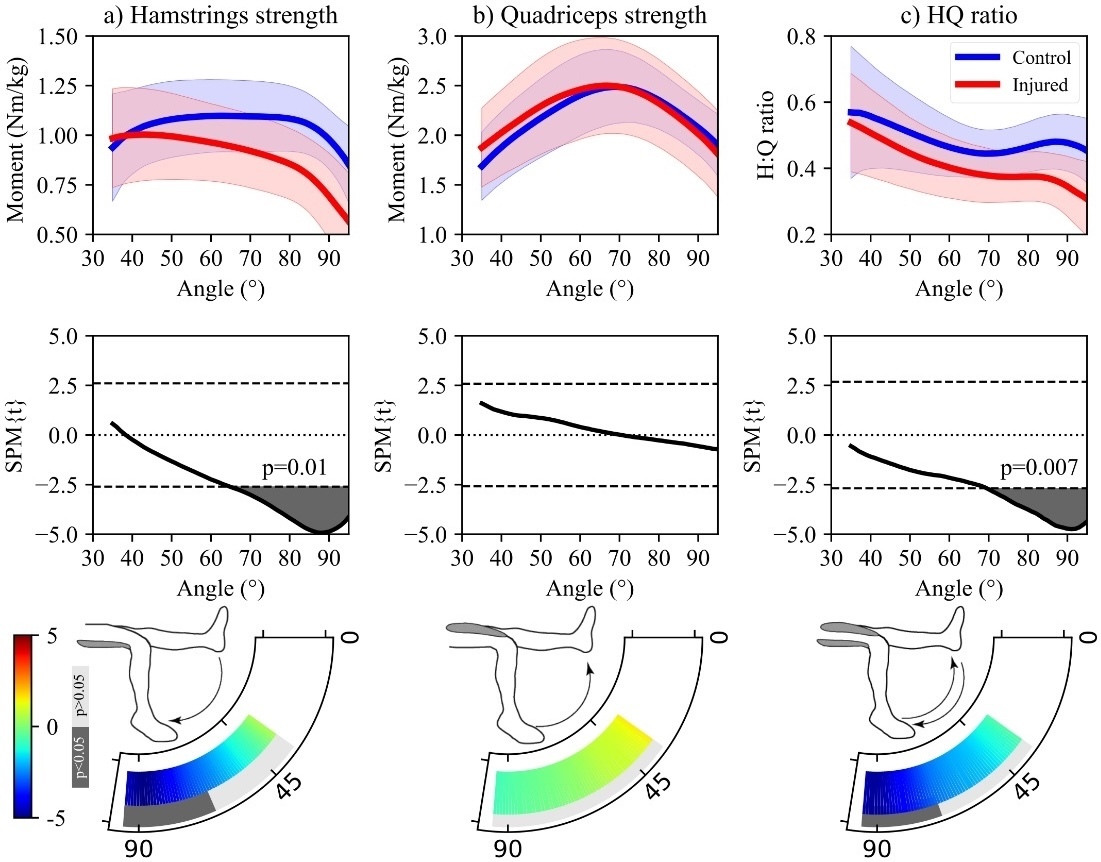 Hamstrings and Quadriceps Weaknesses Following Anterior Cruciate ...