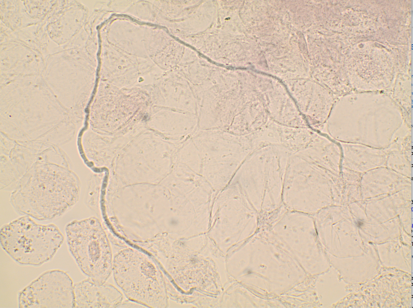 Tinea Corporis: Make the Diagnosis Before You Treat | Published in ...