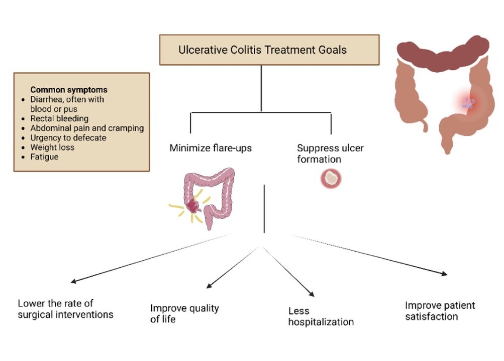 ulcerative colitis medication