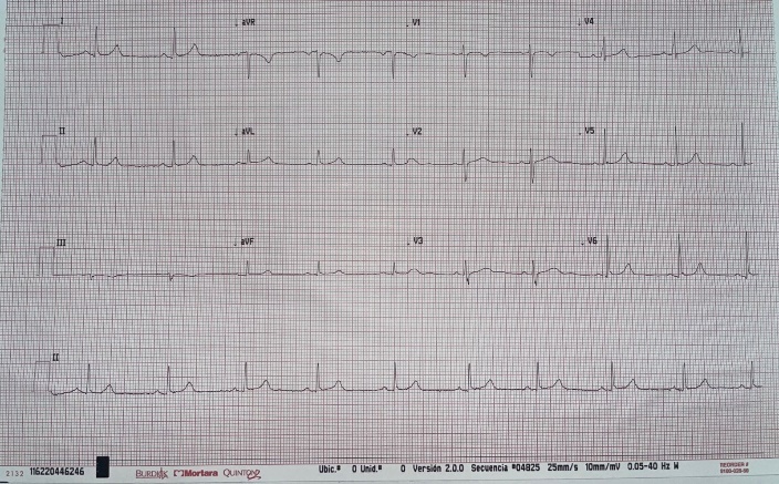 Coumadin Ridge | Published in Journal of Brown Hospital Medicine