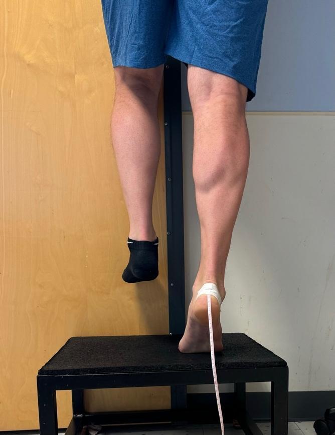 Rehabilitation and Return to Sports after Achilles Tendon Repair ...