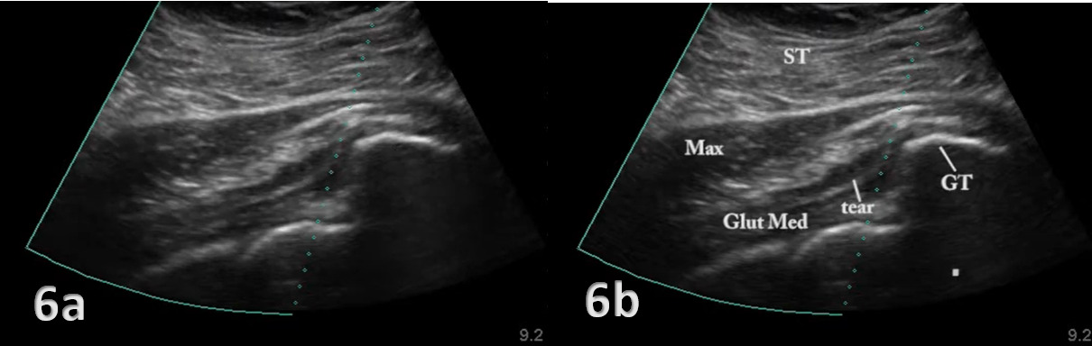 The Utilization of Diagnostic Musculoskeletal Ultrasound in the ...