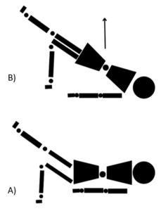 Clinical Progression and Load Management For Proximal Hamstring ...