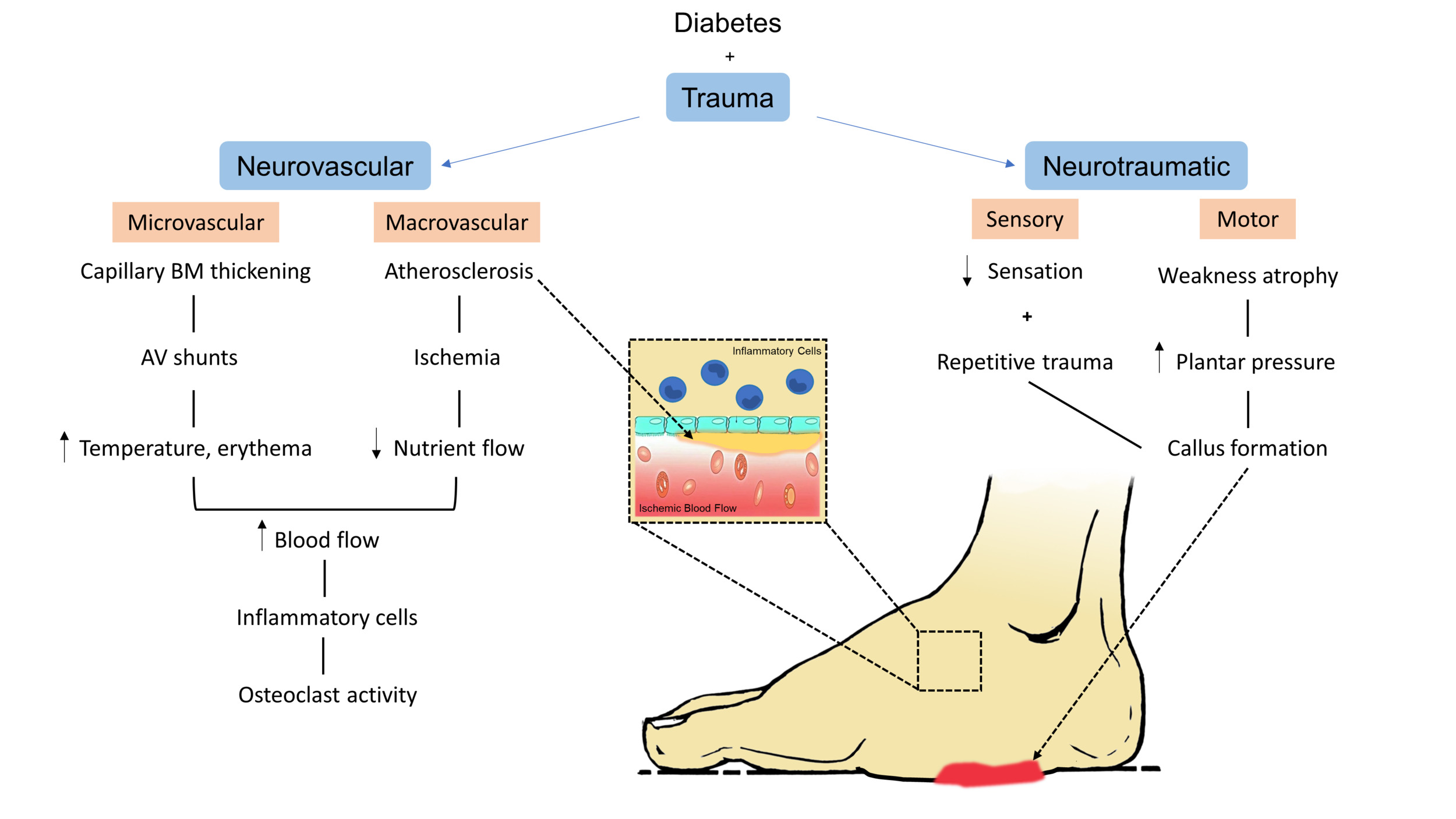 Charcot Neuroarthropathy: Current Concepts | Published in SurgiColl