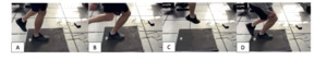 Single-Leg Vertical Hop Test Detects Greater Limb Asymmetries Than ...