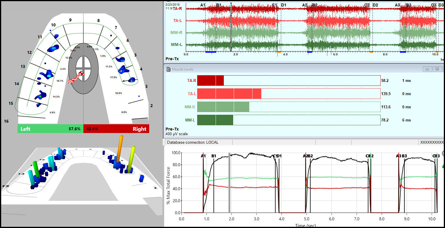 Digital evaluation of Occlusion in Treating a Patient Suffering from ...