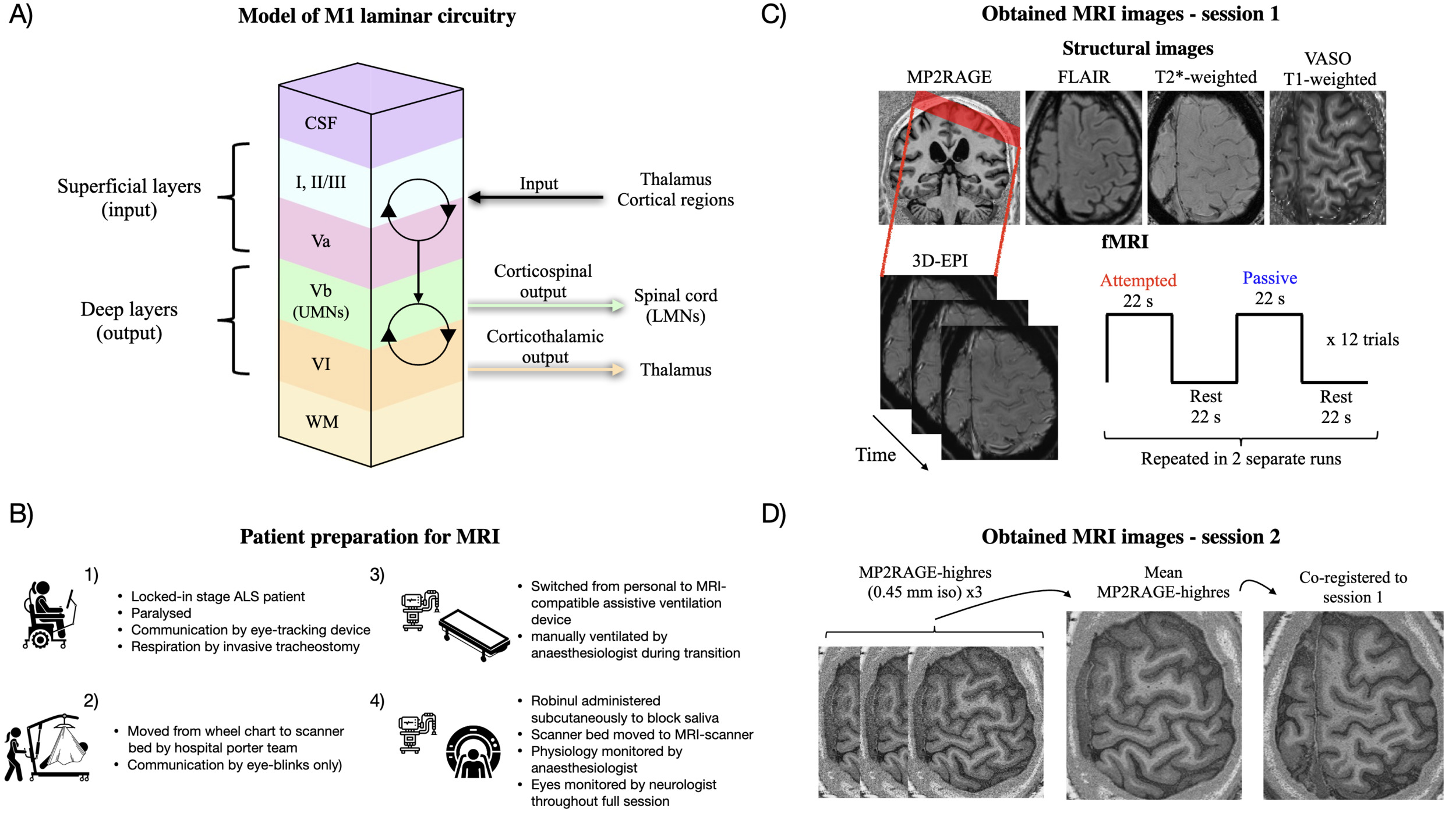Laminar fMRI in the locked-in stage of amyotrophic lateral sclerosis ...