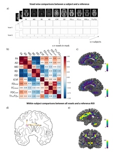 MVComp toolbox: MultiVariate Comparisons of brain MRI features ...