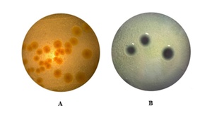 Application of Bacteriophages to Treat Toxic Gas-producing Bacteria ...