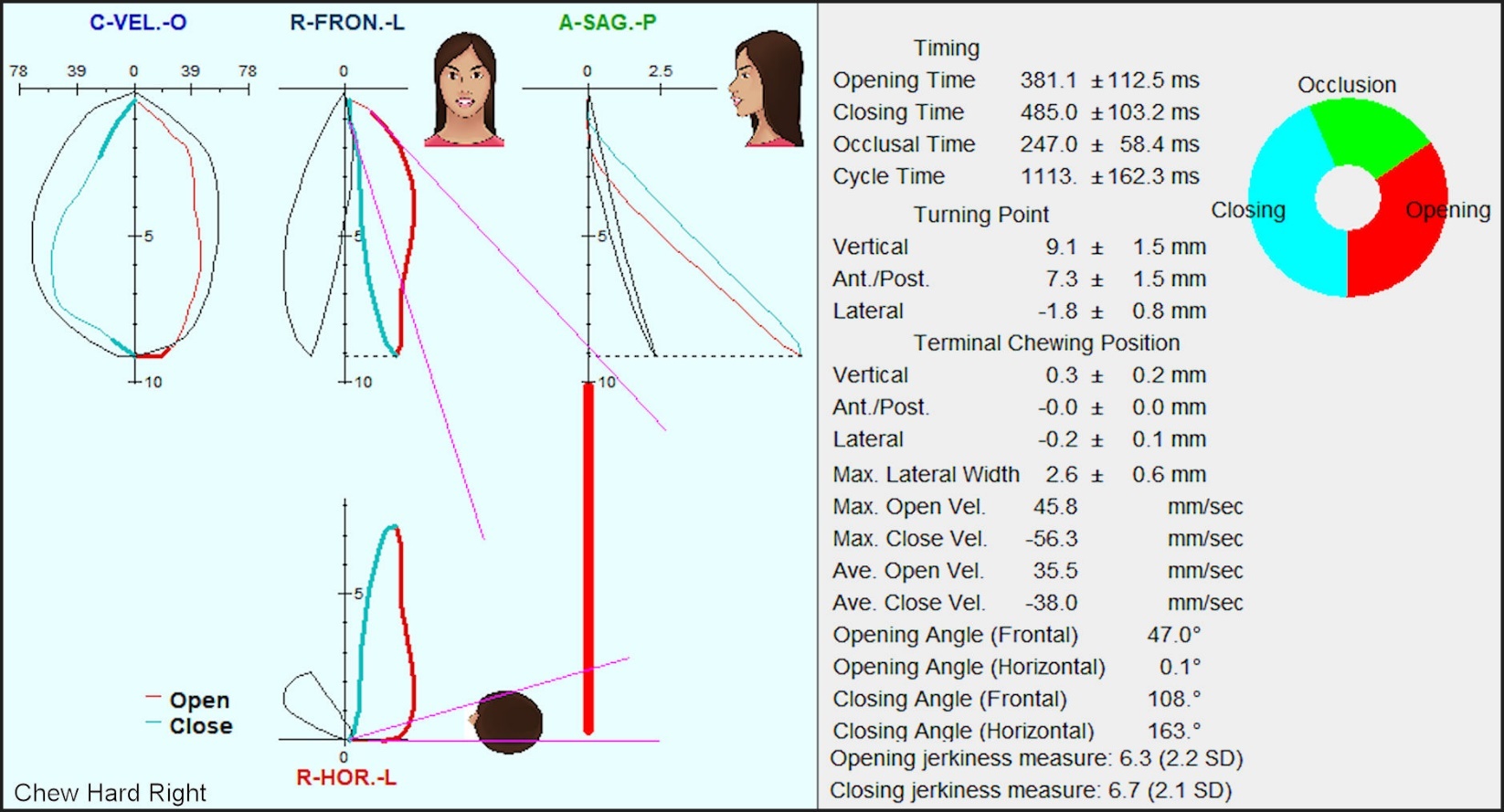 The complementary diagnostic relationship between Jaw Tracking and MR ...