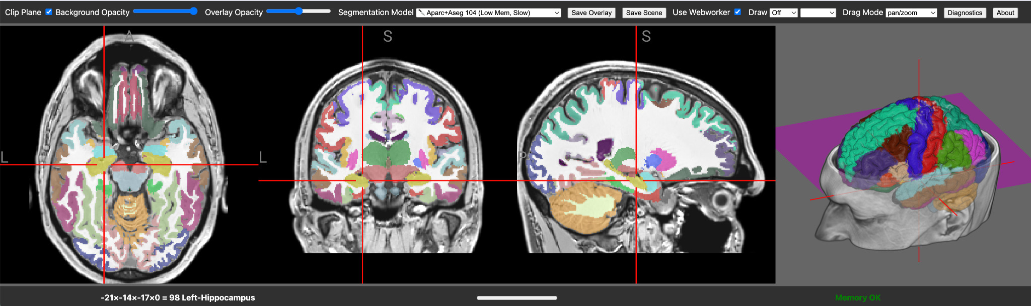 Brainchop: Providing an Edge Ecosystem for Deployment of Neuroimaging Artificial Intelligence ...