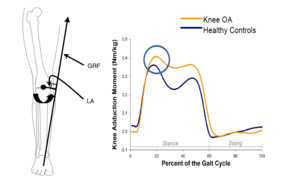 Summary of outcomes of a non-invasive biomechanical therapy for ...