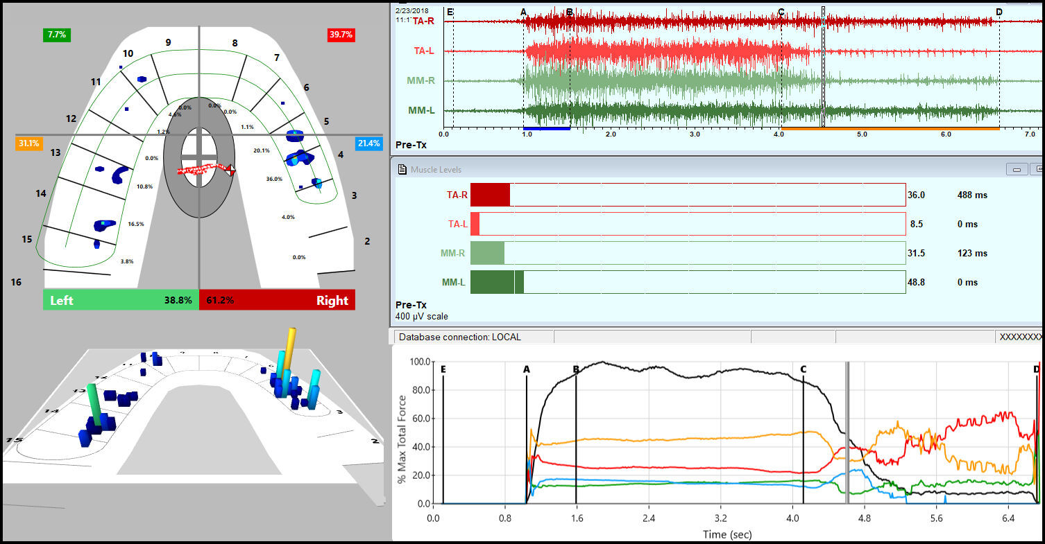 Digital evaluation of Occlusion in Treating a Patient Suffering from ...
