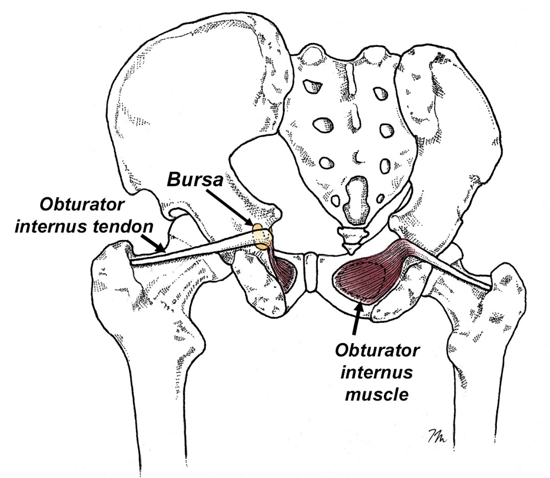 OBTURATOR INTERNUS CONTRACTURE: AN UNDERAPPRECIATED CAUSE OF PELVIC FLOOR AND SCIATIC PAIN ...