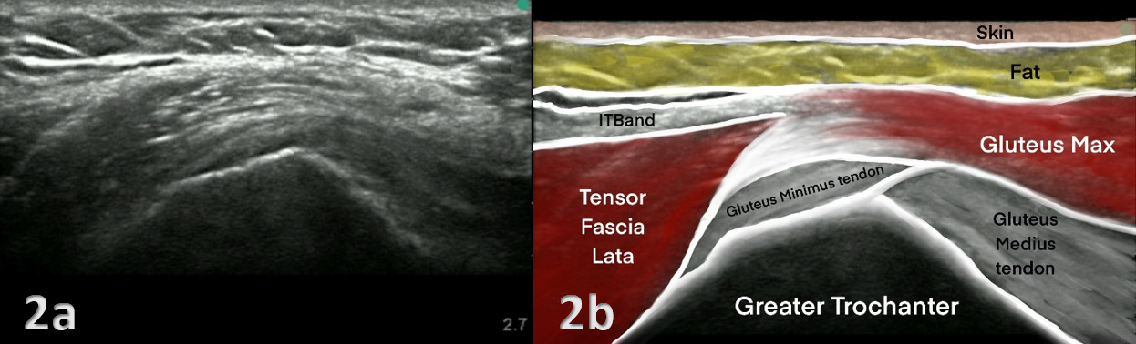 The Utilization of Diagnostic Musculoskeletal Ultrasound in the ...