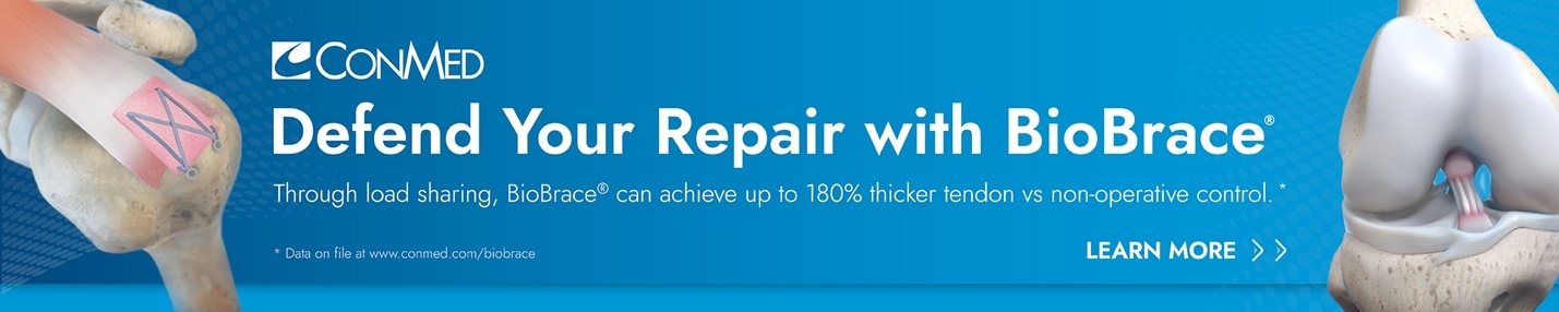 Short-term radiographic and clinical outcomes of arthroscopic rotator ...