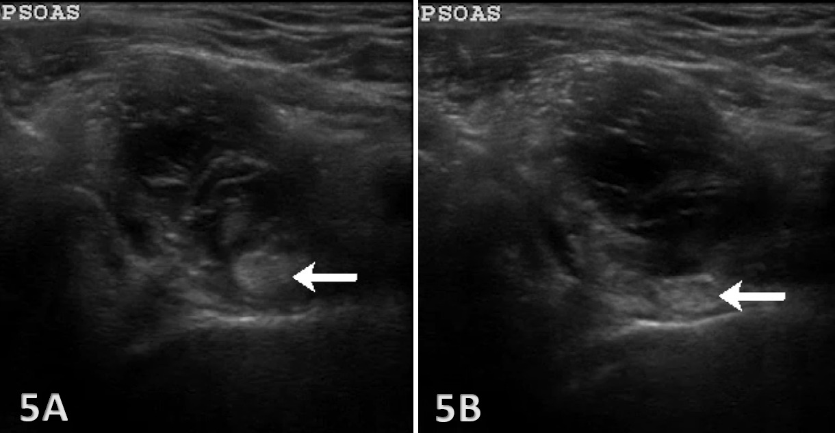 The Use of Diagnostic Musculoskeletal Ultrasound for the Evaluation of ...