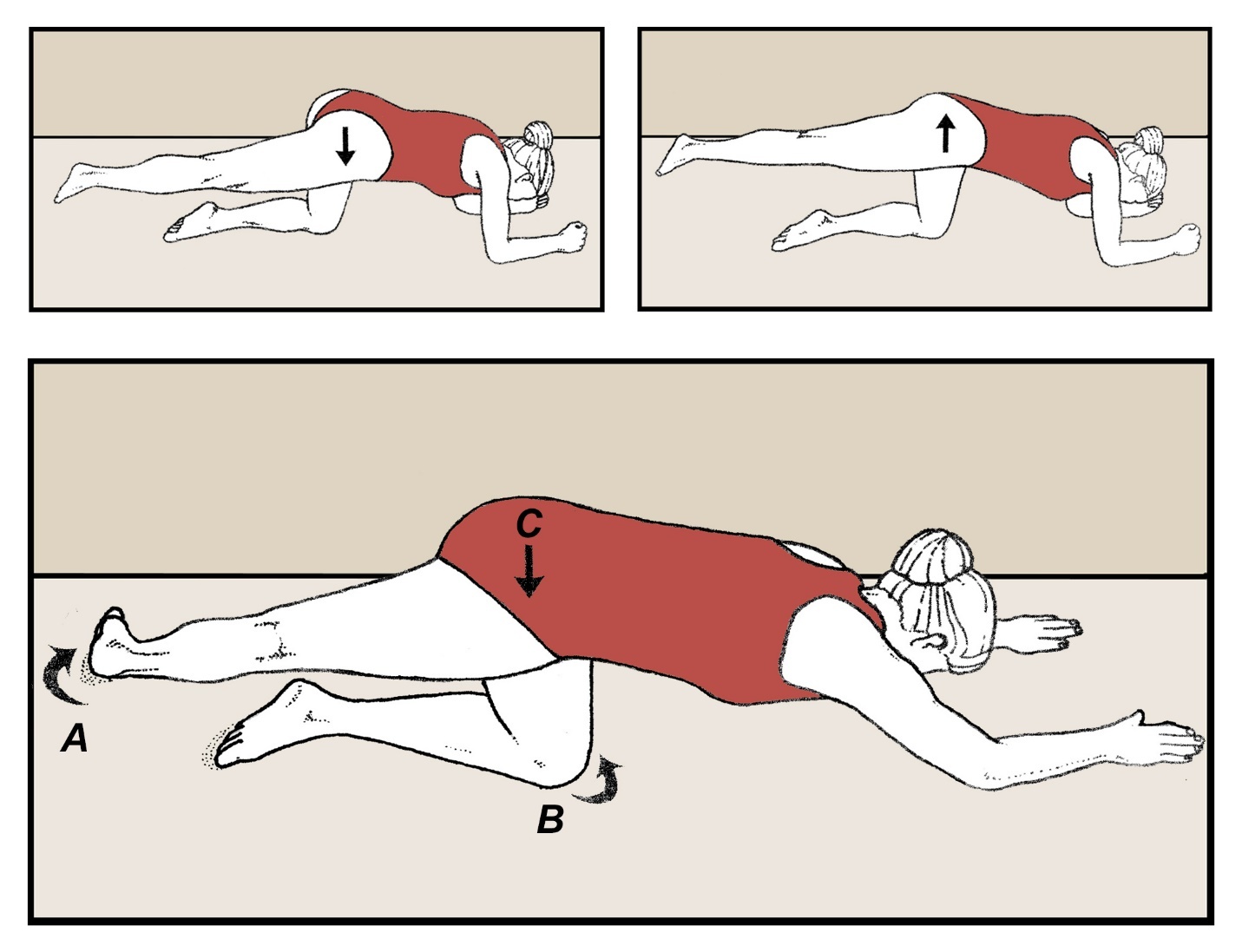 OBTURATOR INTERNUS CONTRACTURE: AN UNDERAPPRECIATED CAUSE OF PELVIC ...