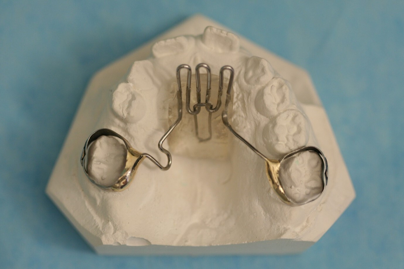An Update in Non-Nutritive Sucking Habit Cessation | Published in ...