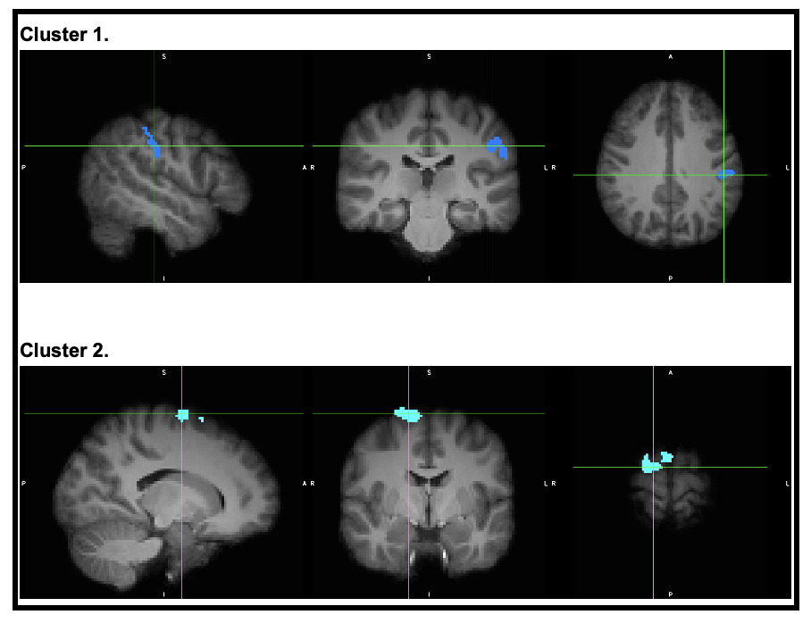 The Impact of Visual Perturbation Neuromuscular Training on Landing ...