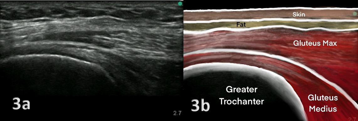 The Utilization of Diagnostic Musculoskeletal Ultrasound in the ...
