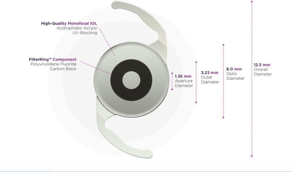 Refractive Surgery Overview | Published in CRO (Clinical & Refractive ...