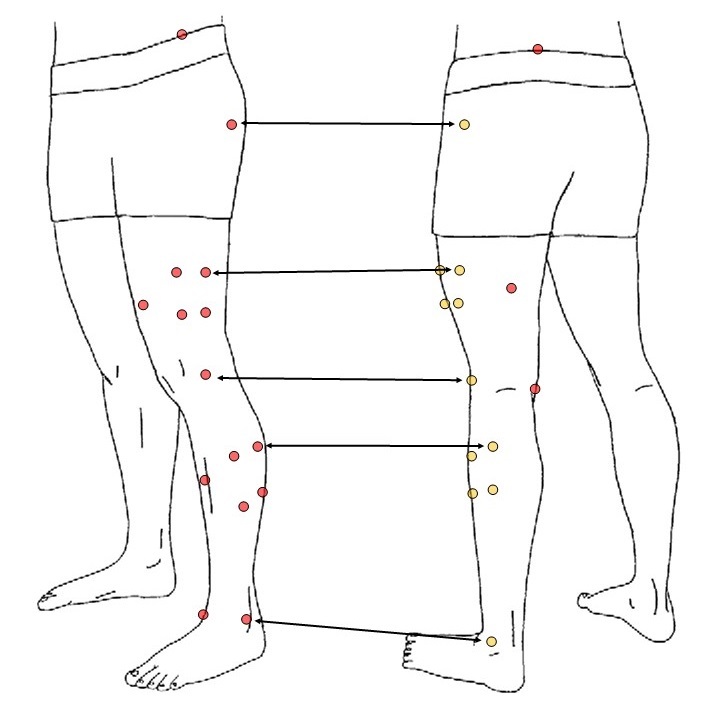 Muscle Activity and Kinematics During Three Hamstring Strengthening ...