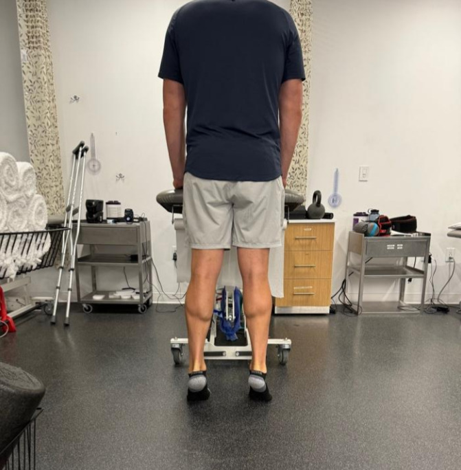 Rehabilitation and Return to Sports after Achilles Tendon Repair ...