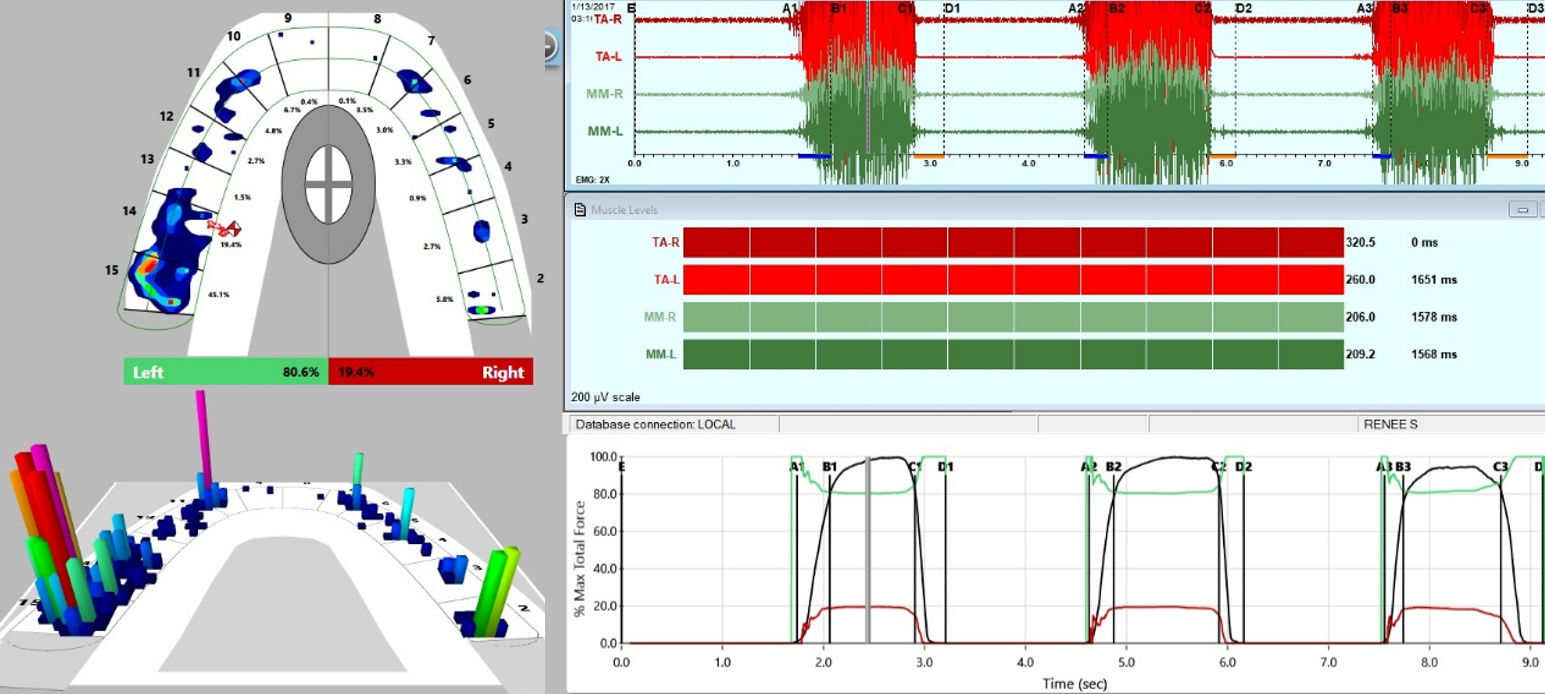 Vicious Cycle Theory vs Pain Adaptation Model: A Structured Critical ...