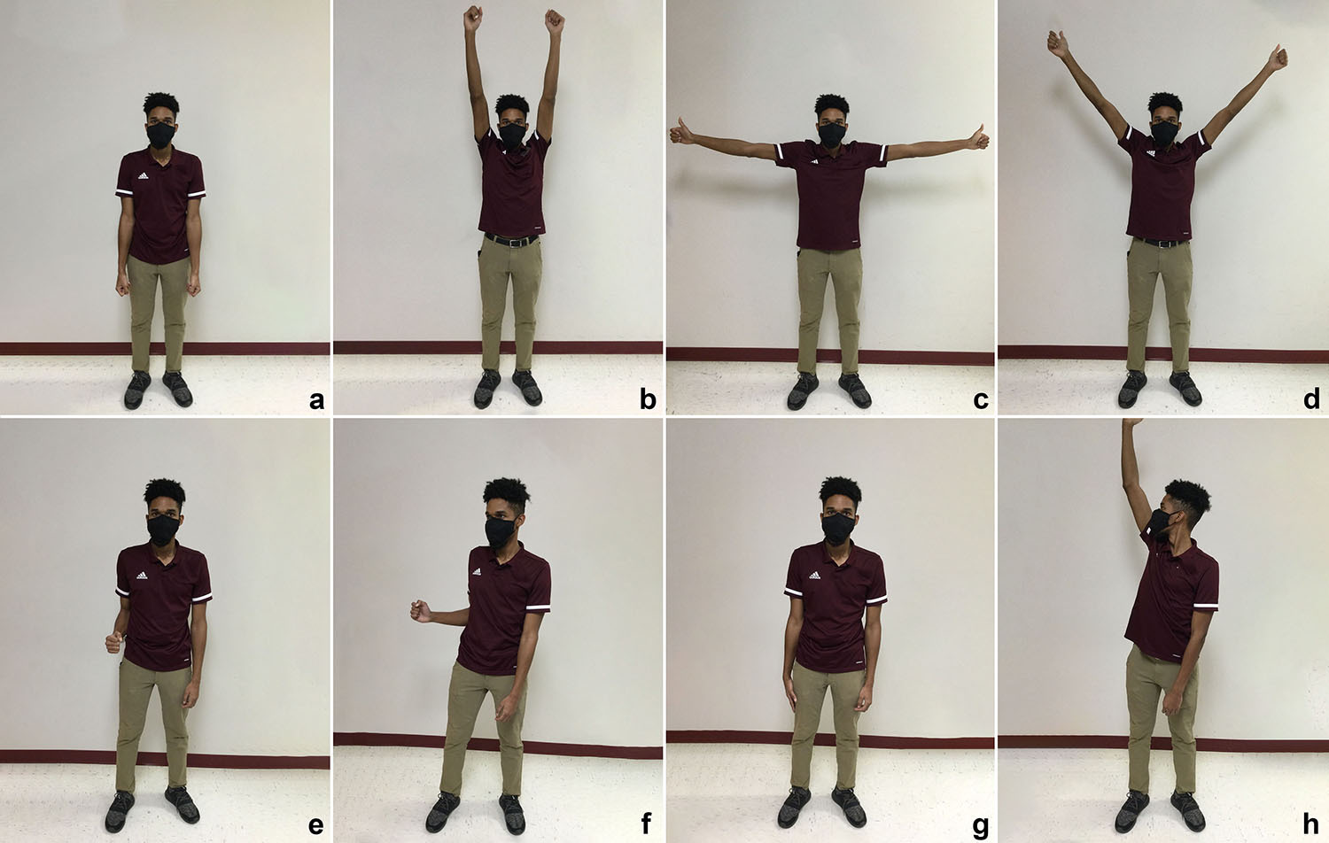 Nonoperative Management of Traumatic Acromioclavicular Joint Injury: A ...
