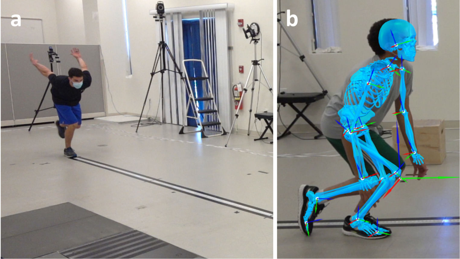 Hop Distance Symmetry Moderately Reflects Knee Biomechanics Symmetry ...