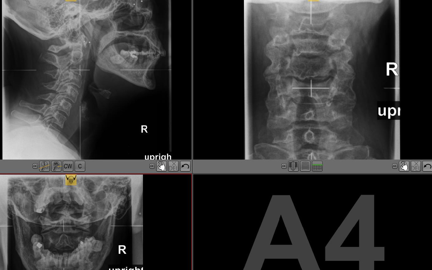 CONE BEAM COMPUTED TOMOGRAPHY: TECHNOLOGY OVERVIEW, DOSE, AND UTILITY CONSIDERATIONS FOR ...