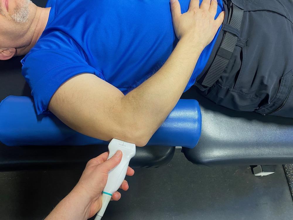 Triceps Tendon Avulsion in a Soldier: A Case Report | Published in ...