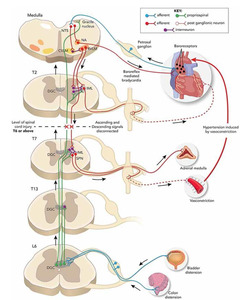 Anesthesia considerations in spinal cord injury patients: An overview ...