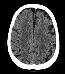 The emergence of additional causes of thiamine deficiency in the modern ...