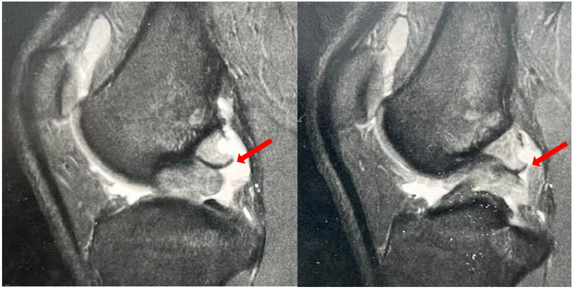 Physical and Muscular Performance in a Professional Soccer Player with ...