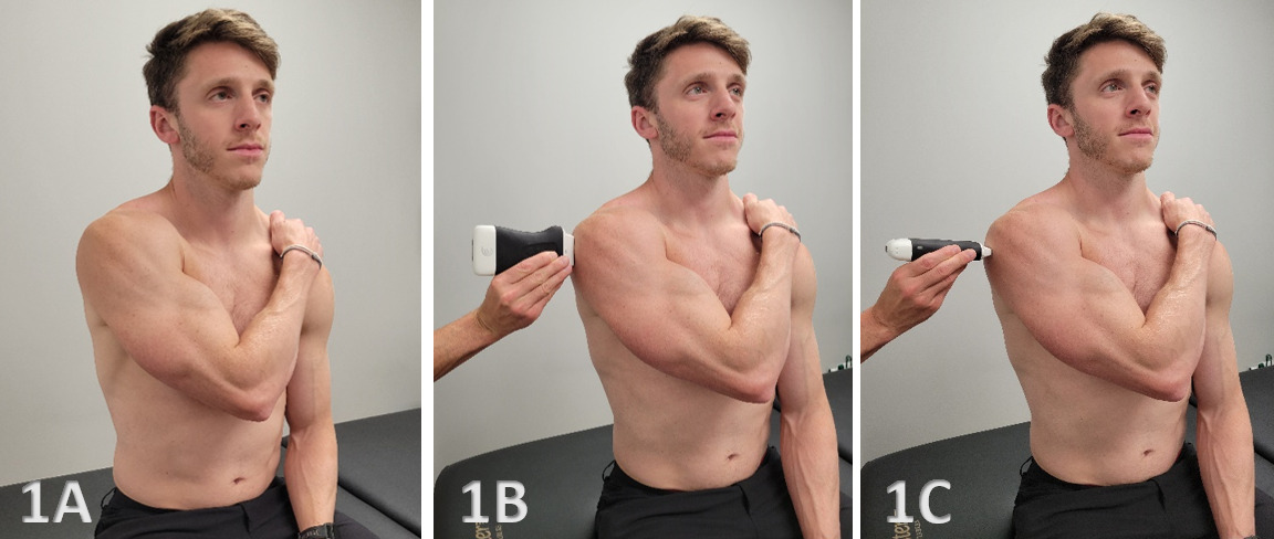 Utilizing Diagnostic Musculoskeletal Ultrasound for Assessment of the ...